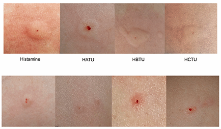 What are the advantages and differences between HATU, HBTU, and HCTU as ...